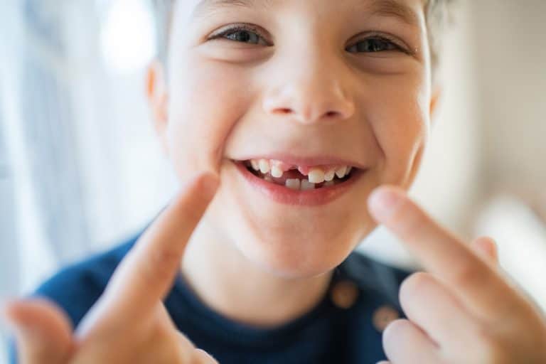 Losing Baby Teeth When Do Kids Lose Teeth and What to Expect - MD Smiles